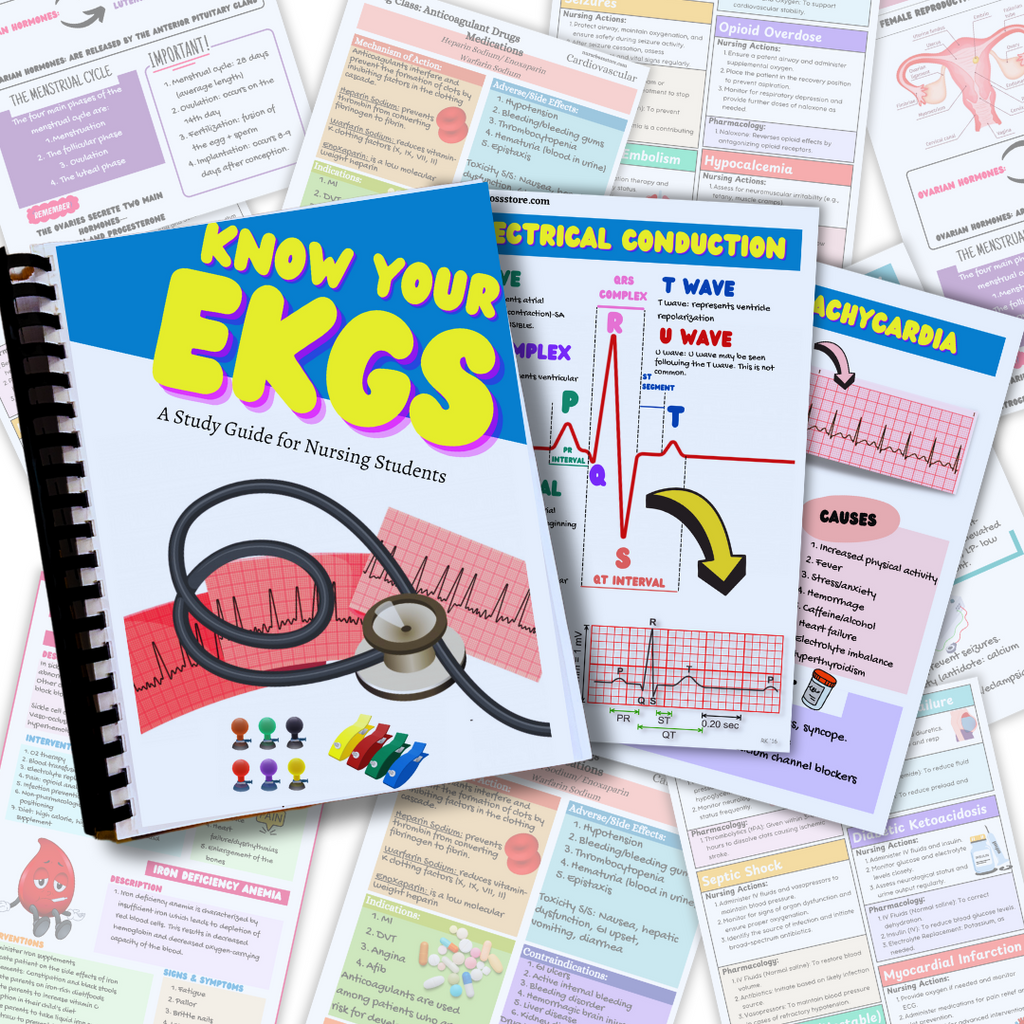 EKG Study Guide (Digital-PDF) – nursebossstore